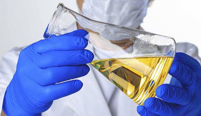 Formol Significado ️ ¿Para qué se utiliza? 10 Usos ¿Es tóxico el formol?